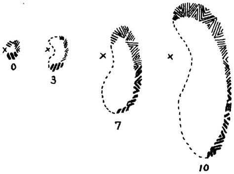Drawings Of Spatiotemporal Progression Of Migraine Visual Aura Symbol