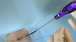 Single Perclose Proglide Suture Mediated Closure System Abbott