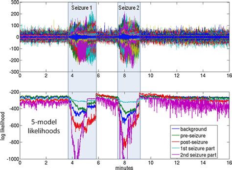 Modeling Electrocortical Source Dynamics Of Intracranial Eeg Data In