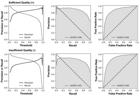 Ophthopedia Updateinternal Validation Of A Convolutional Neural