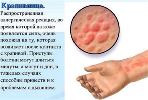EPH Bomb (Эф Бомб) жиросжигатель. Отзывы реальные женщин, где купить ...