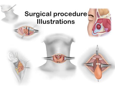 Anatomy Medical Illustrations Scientific Body Parts Surgical