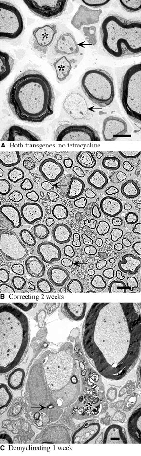 Electron Micrographs Of Cross Sections Of Sciatic Nerves A Affected