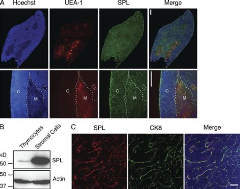 Spl Is Highly Expressed In Tecs A Confocal Microscopy Of Wt Thymus Download Scientific