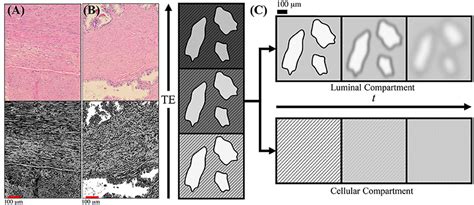 Frontiers Characterization Of Prostate Microstructure Using Water Diffusion And Nmr Relaxation