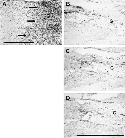 Structure Of Rubrospinal Tract Semantic Scholar