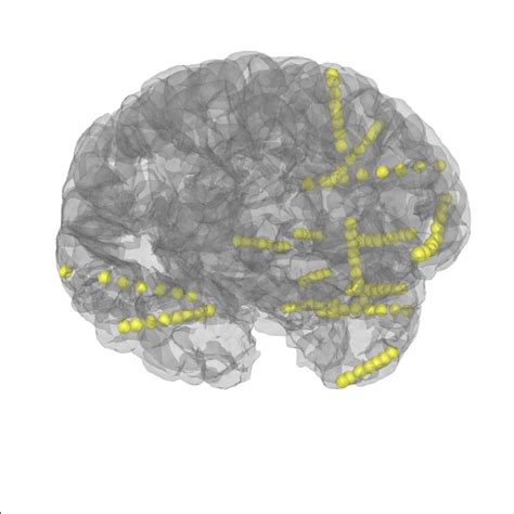 Locating Intracranial Electrode Contacts — Mne 1 3 1 Documentation