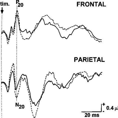 Motor Evoked Cortical Potentials Registered Over Frontal Motor Areas Download Scientific
