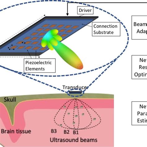 Sketch Of Intended Adaptable Setup For Networked Wireless Implantable