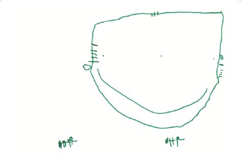 6 Years Old Boy Ados Score 13 Severe Symptoms Iq 71 Download