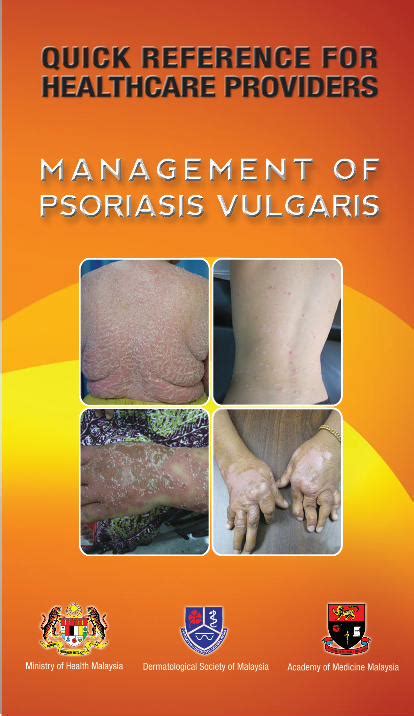 Management Of Psoriasis Vulgaris Dqjjn