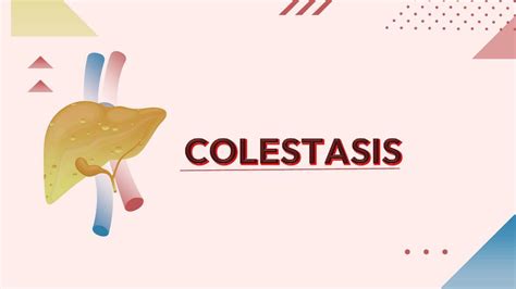 Colestasis Morelia Centeno Udocz