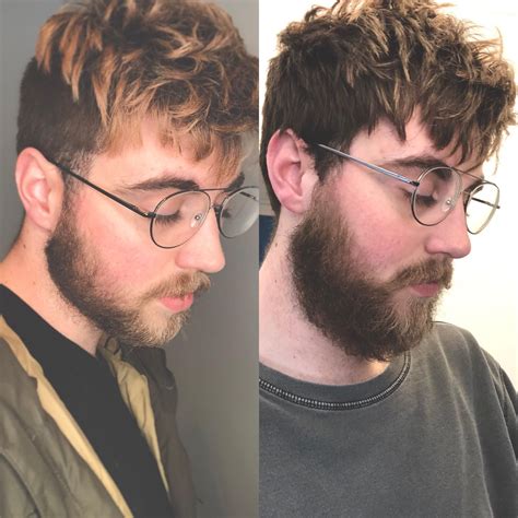 Easy Patchy Beard Solution Naturally At Home Artofit