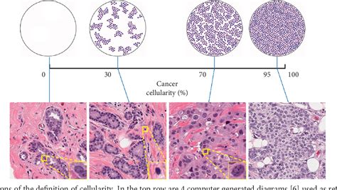 Figure 1 From Direct Cellularity Estimation On Breast Cancer Histopathology Images Using