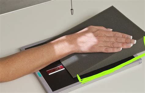 Scaphoid Ulnar Deviation Modified Stretcher Flashcards Quizlet