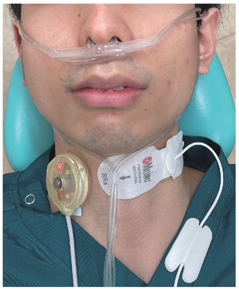 Figure 1 From Original Usefulness Of New Acoustic Respiratory Sound Monitoring With Artificial