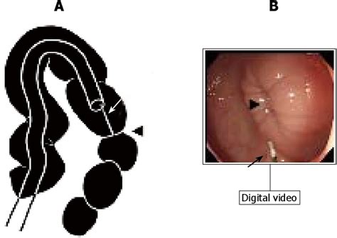 Figure 1 From Objective Assessment Of The Antispasmodic Effect Of