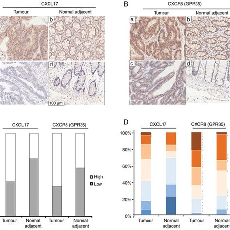 Cxcl17 And Cxcr8 Expression Levels In Colon Cancer And Healthy