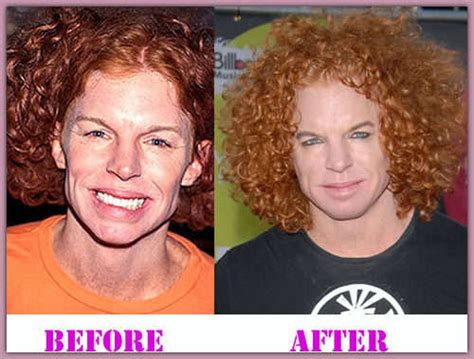 Carrot Top Before And After