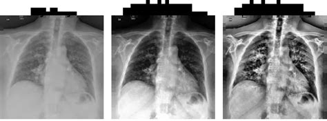 Image Processing Tutorial Using Scikit Image — Noise By Betul Mescioglu Medium