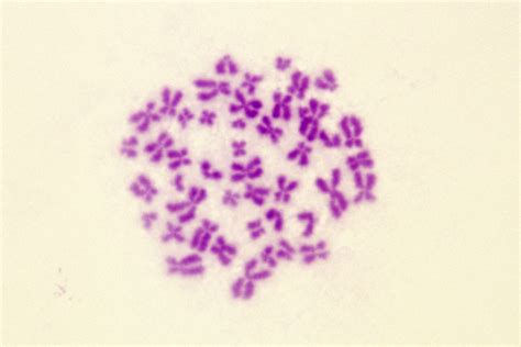 Human Dna Sequence Example