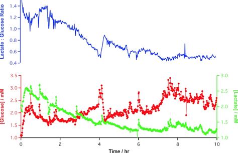 analysis of data collected during icu monitoring the top graph shows