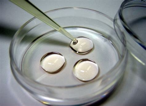 Ksom Potassium Simplex Optimzed Medium Catalog No Csr R B074 Csr