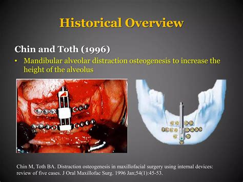 Distraction Osteogenesis In Orthodontics Pptx