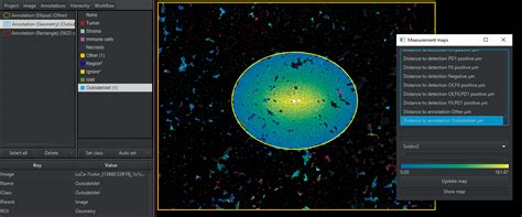 Spatial Information Of Positive Pixel Count Detections Image Analysis
