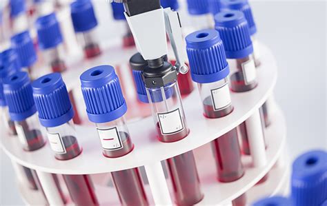 Systematically Identifying The Problem Of Mislabeled Specimens Labtag Blog