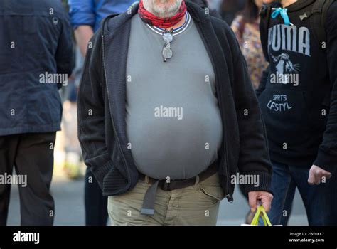 Undated File Photo Of A Man Obesity And Alcohol Are Driving Up Bowel