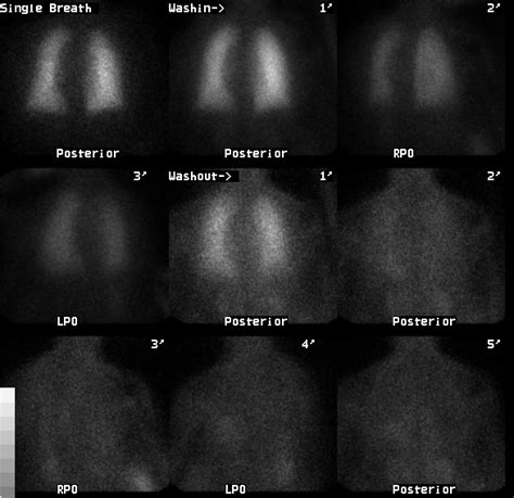MIR Teaching File Case Vq025