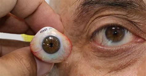 Prosthetic Eye Guide Types Process Costs And Care Tips