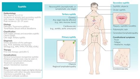 Syphilis Stages Diagram