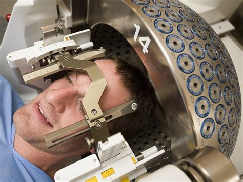 What Is Radiosurgery Types Gamma Knife Radiosurgery Sutured