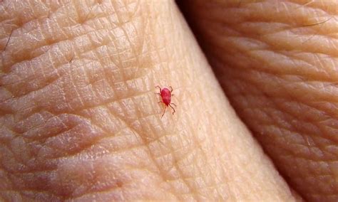 Doxycycline Azithromycin Combo Therapy Superior To Monotherapies For Severe Scrub Typhus