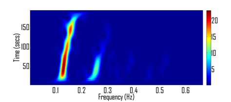 Time Frequency Tf Analysis Of Measured Heart Rate Signals A