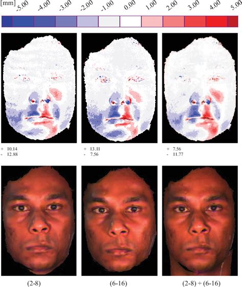 Figure 1 From Selective Facial Nerve Stimulation With An Array