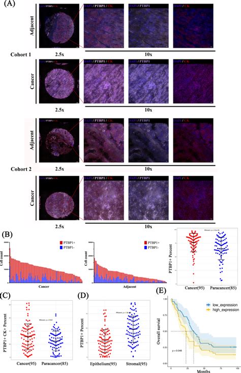 A Multiple Immunofluorescence Technology Was Used To Stain Gc Tissue Download Scientific