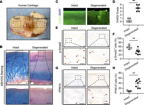 Jci Insight Protein Phosphatase Ppm1a Inhibition Attenuates Osteoarthritis Via Regulating Tgf