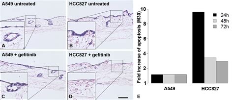 A Combined 3d Tissue Engineered In Vitroin Silico Lung Tumor Model For