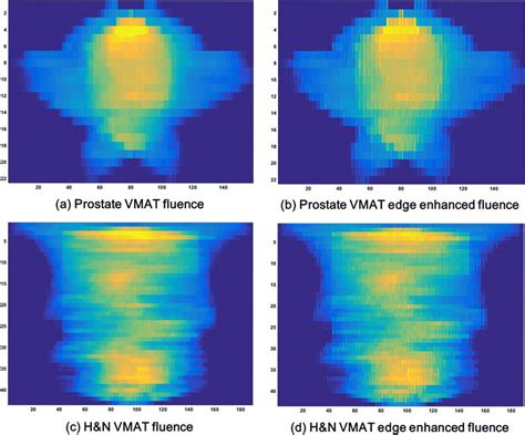 Edge Enhanced And Non Enhanced Fluence Of Vmat The Fluences With Download Scientific Diagram