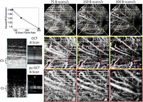 Visualization Of The Choroidal Layer With Pv Oct In Vivo In The Nude