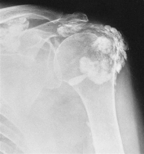 The Superficial Soft Tissues Radiology Key