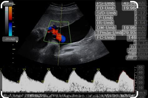 La Ecografía Ginecológica