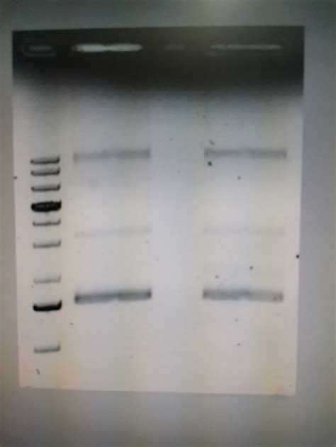 What Is The Problem With This Plasmid Digestion Researchgate