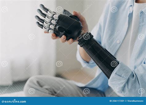Person With Disability Puts Together Bionic Prosthetic Arm Ad Of High