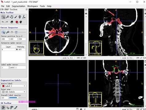 医学图像处理入门知识 格式dicom，mhdraw 坐标系 Itk Snap 重采样mhd格式的cbct文件 Csdn博客