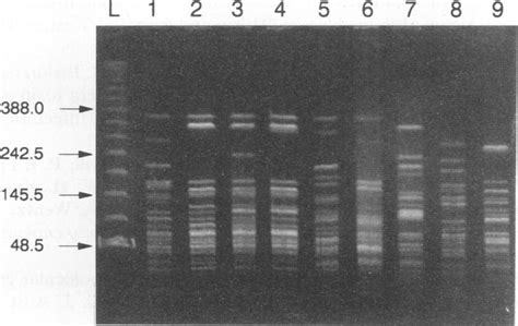 Pfge Banding Patterns Of Noti Digested Total Cellular Dnas From