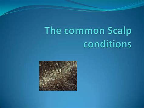 Scalp Conditions Pptx